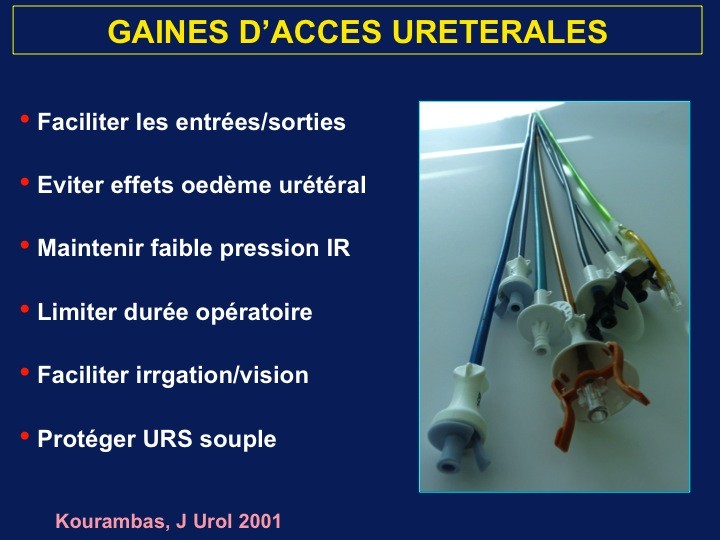 Urofrance | Communications orales - Lithiase : urétéro-rénoscopie ...