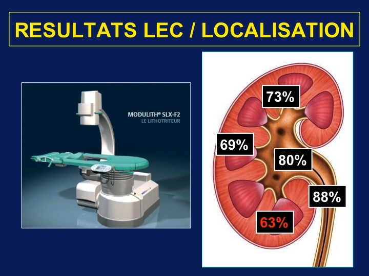 Urofrance | Urologie du Monde - Urofrance