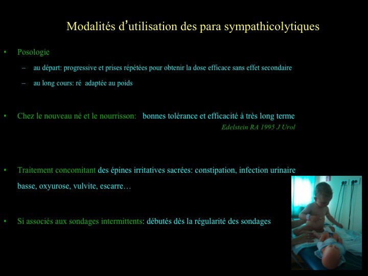 Urofrance | Comment améliorer le réservoir vésical des vessies ...