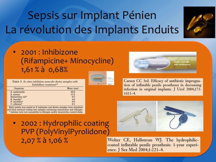 Urofrance | Infection et implant pénien - Urofrance